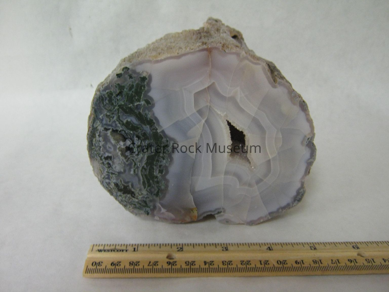 Limb Cast