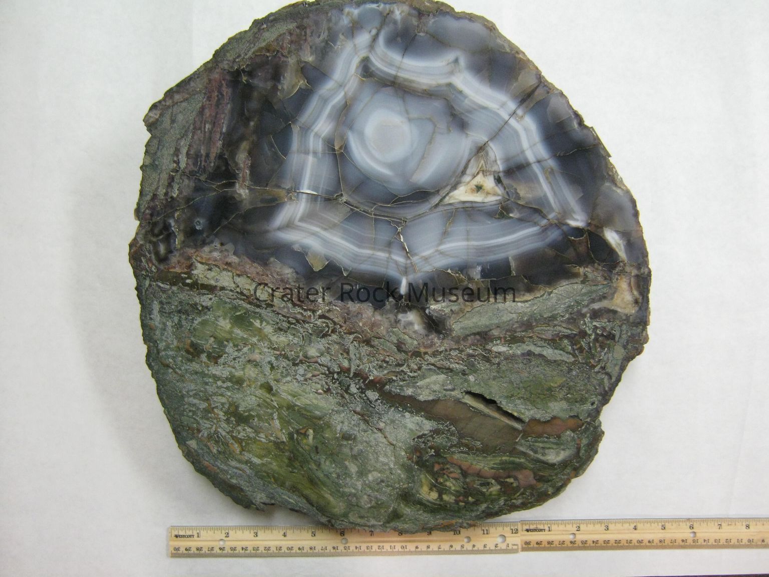 Limb Cast